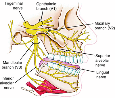 Neuralgia do trigêmeo